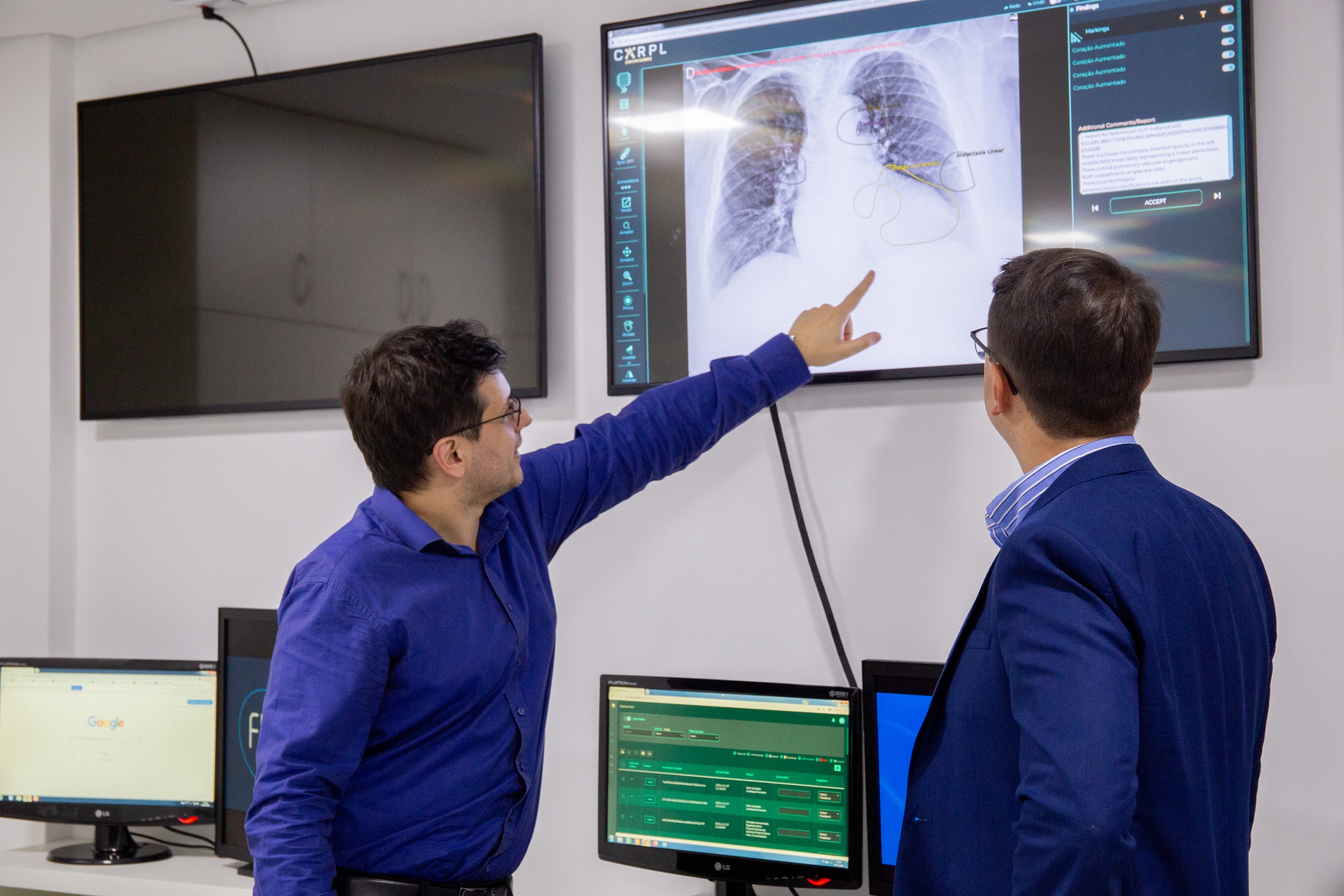 Raios-X de tórax com IA têm resultado acelerado em mais de 90%